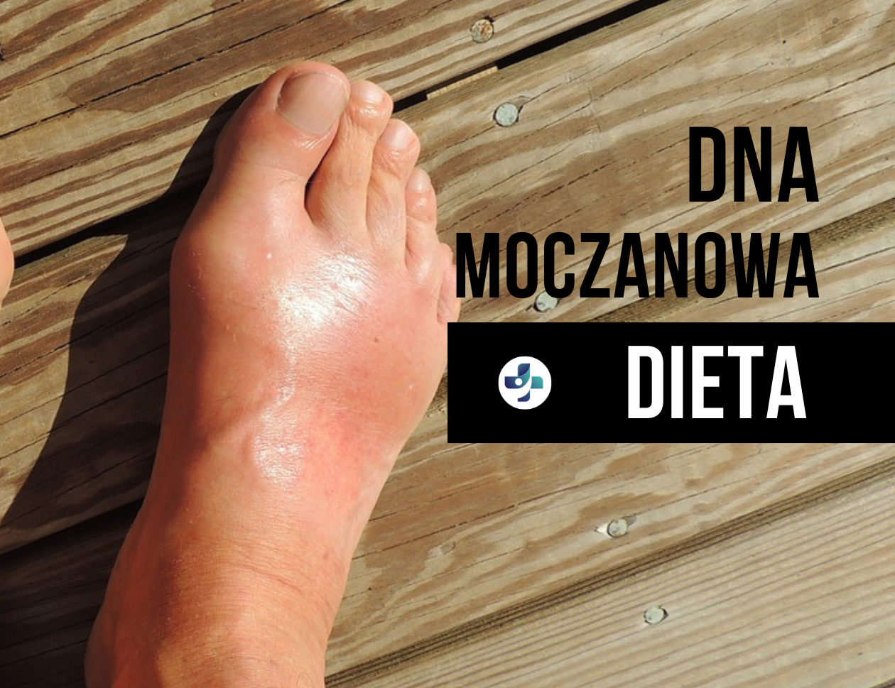 Dna moczanowa - dieta | Centrum Leczenia Otyłości